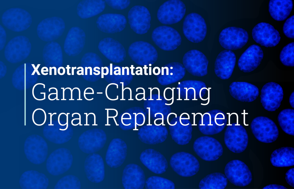 Life-changing xenotransplantation breakthroughs - World Medical ...